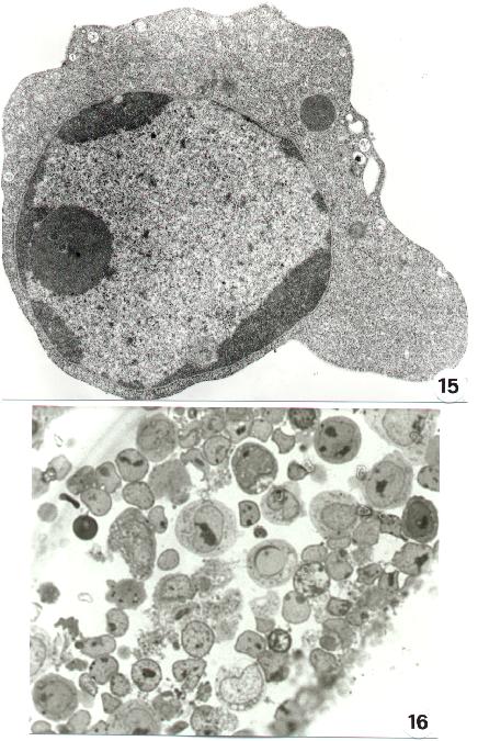 Morphological Aspects of Apoptosis