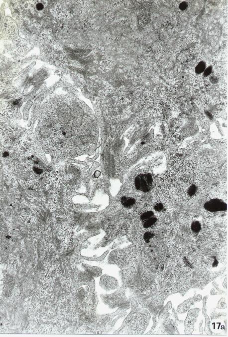 Morphological Aspects of Apoptosis