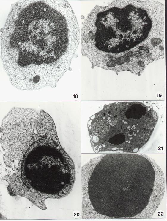 Morphological Aspects of Apoptosis