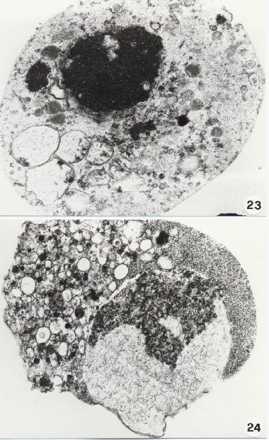 Morphological Aspects of Apoptosis